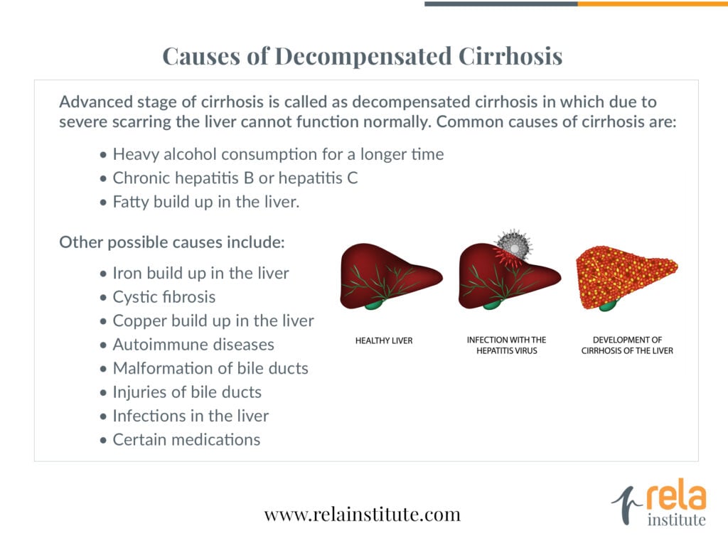 Decompensated Cirrhosis - Rela Hospital