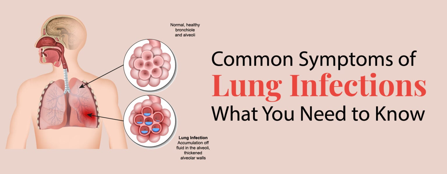 Common Symptoms of Lung Infections: What You Need to Know