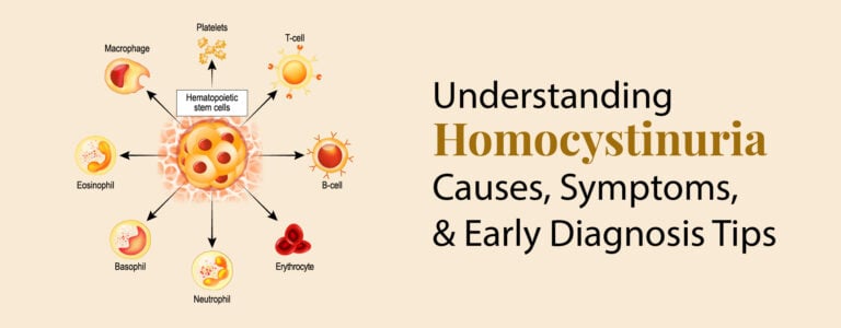 Understanding Homocystinuria: Causes, Symptoms, and Early Diagnosis Tips