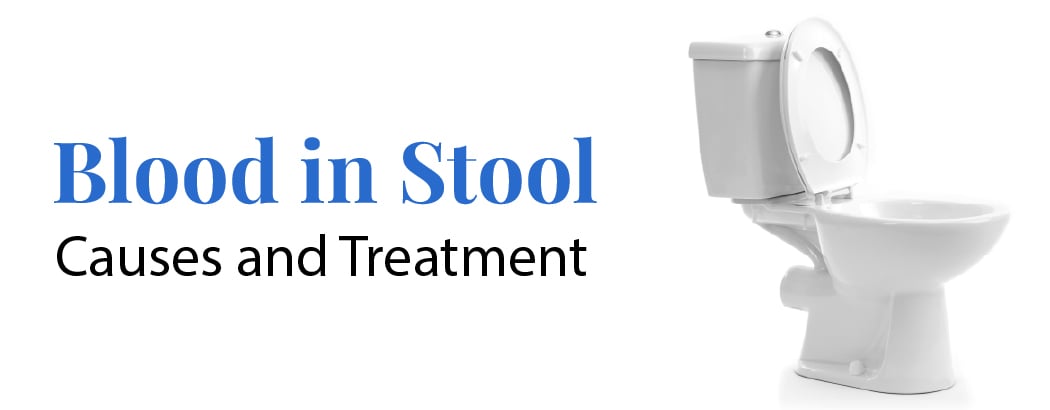 Blood in Stool (Rectal Bleeding): Causes and Treatment