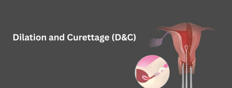 Dilation and Curettage (D&C): Overview, Recovery, and Care