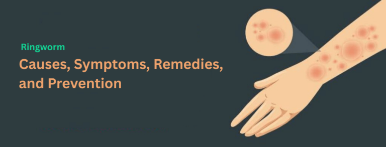 Ringworm: Causes, Symptoms, Remedies, and Prevention