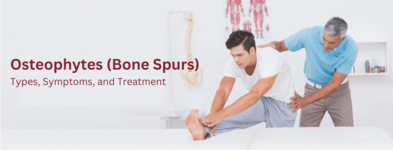 Osteophytes (Bone Spurs): Types, Symptoms, and Treatment Options