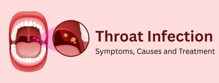 Throat Infection: Symptoms, Causes and Treatment