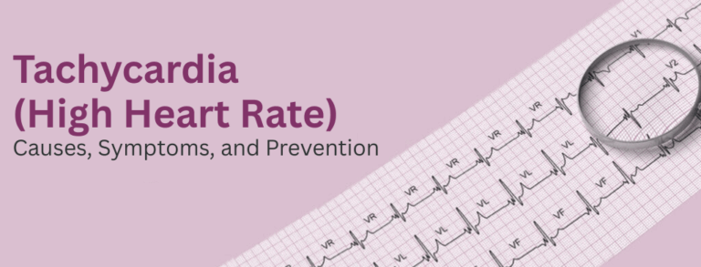 Tachycardia (High Heart Rate): Symptoms, Causes, and Treatments