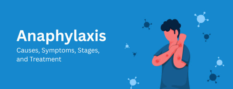 Anaphylaxis: Causes, Symptoms, Stages, and Treatment