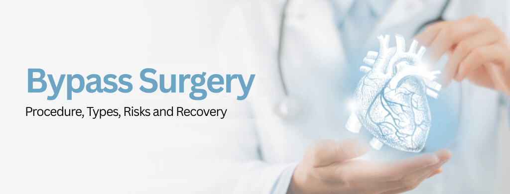 Bypass Surgery: Procedure, Types, Risks and Recovery