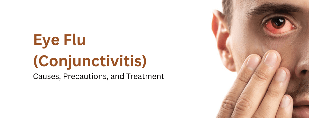 Eye Flu (Conjunctivitis): Causes, Precautions, and Treatment