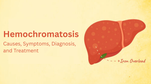Hemochromatosis: Causes, Symptoms, Diagnosis, and Treatment