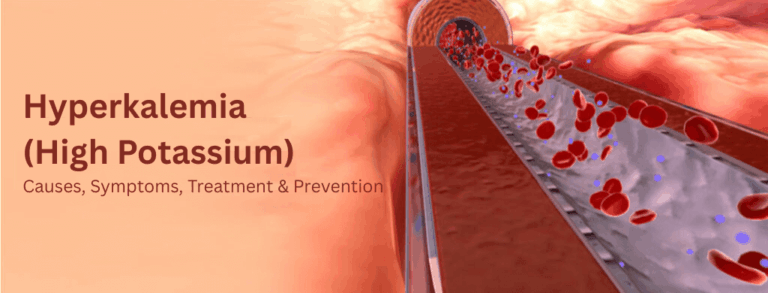 Hyperkalemia (High Potassium) : Causes, Symptoms, Treatment & Prevention