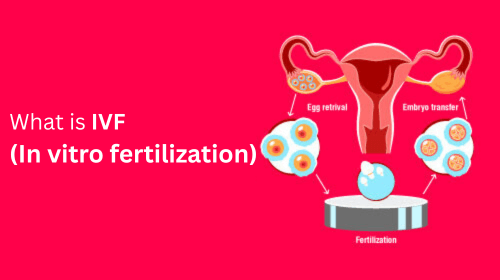 IVF (In vitro fertilization): Process, Benefits, and Risks