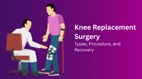Knee Replacement Surgery: Types, Procedure, and Recovery
