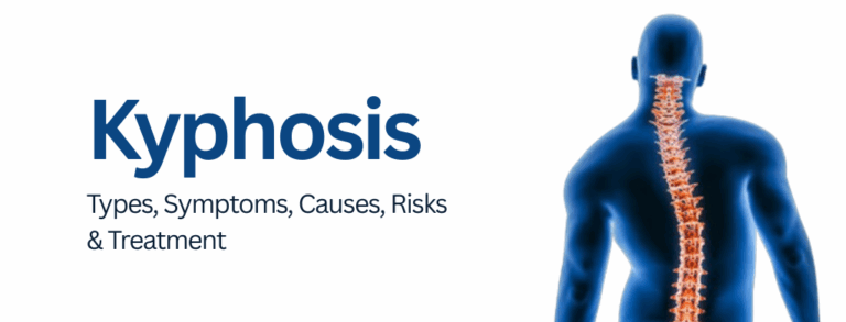 Kyphosis: Types, Symptoms, Causes, Risks & Treatment