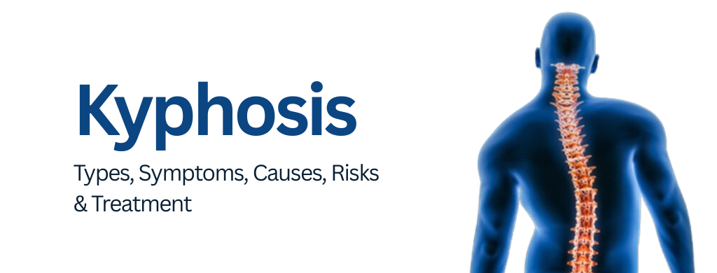Kyphosis: Types, Symptoms, Causes, Risks & Treatment