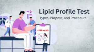 Lipid Profile Test: Types, Purpose, and Procedure