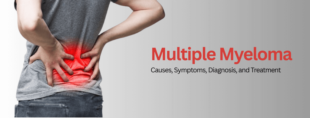 Multiple Myeloma: Causes, Symptoms, Diagnosis, and Treatment