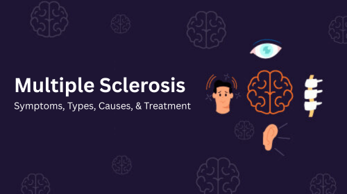 Multiple Sclerosis: Symptoms, Types, Causes, and Treatment