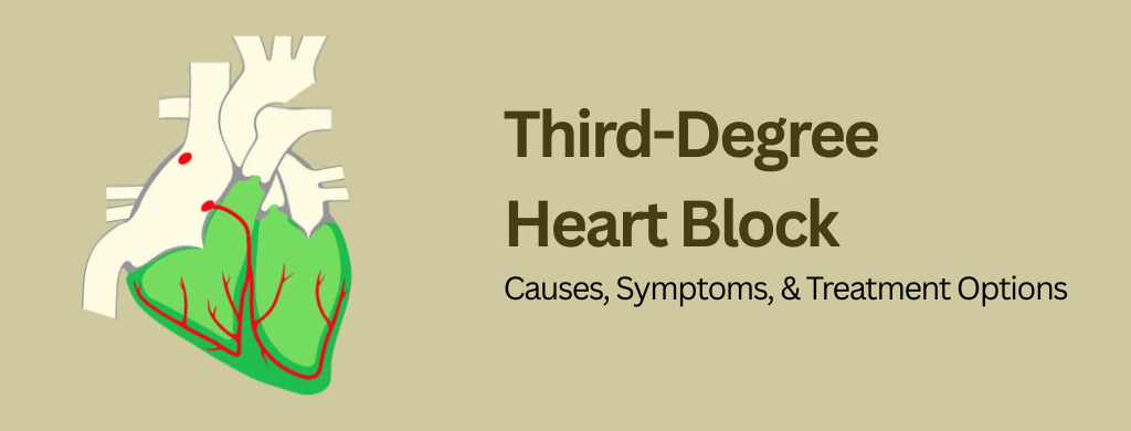 Third-Degree Heart Block: Causes, Symptoms, & Treatment Options
