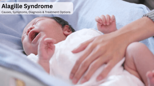 Alagille Syndrome: Causes, Symptoms, Diagnosis & Treatment Options