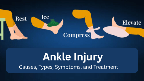 Ankle Injury: Causes, Types, Symptoms, and Treatment
