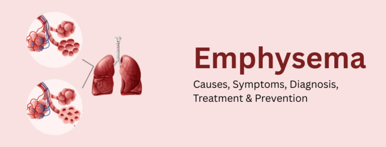 Emphysema: Causes, Symptoms, Diagnosis, Treatment & Prevention