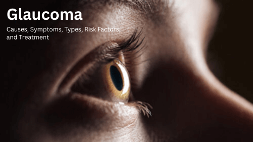 Glaucoma: Causes, Symptoms, Types, Risk Factors, and Treatment