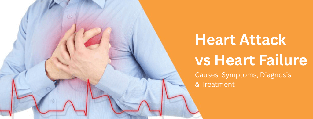 Heart Attack vs Heart Failure: Causes, Symptoms, Diagnosis & Treatment