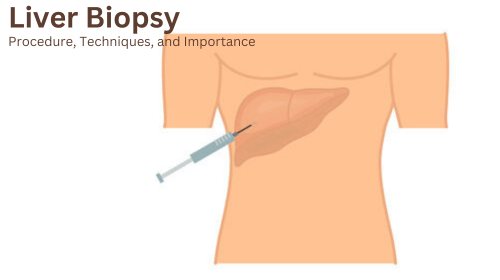 Liver Biopsy: Techniques, Benefits, and Recovery