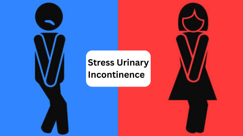 Stress Urinary Incontinence: Causes, Symptoms, Treatments & Prevention
