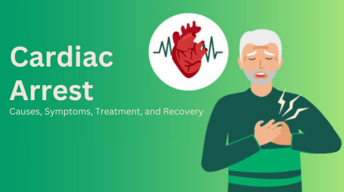 Cardiac Arrest: Causes, Symptoms, Treatment, and Recovery
