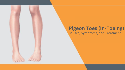 Pigeon Toes (In-Toeing): Causes, Symptoms, and Treatment